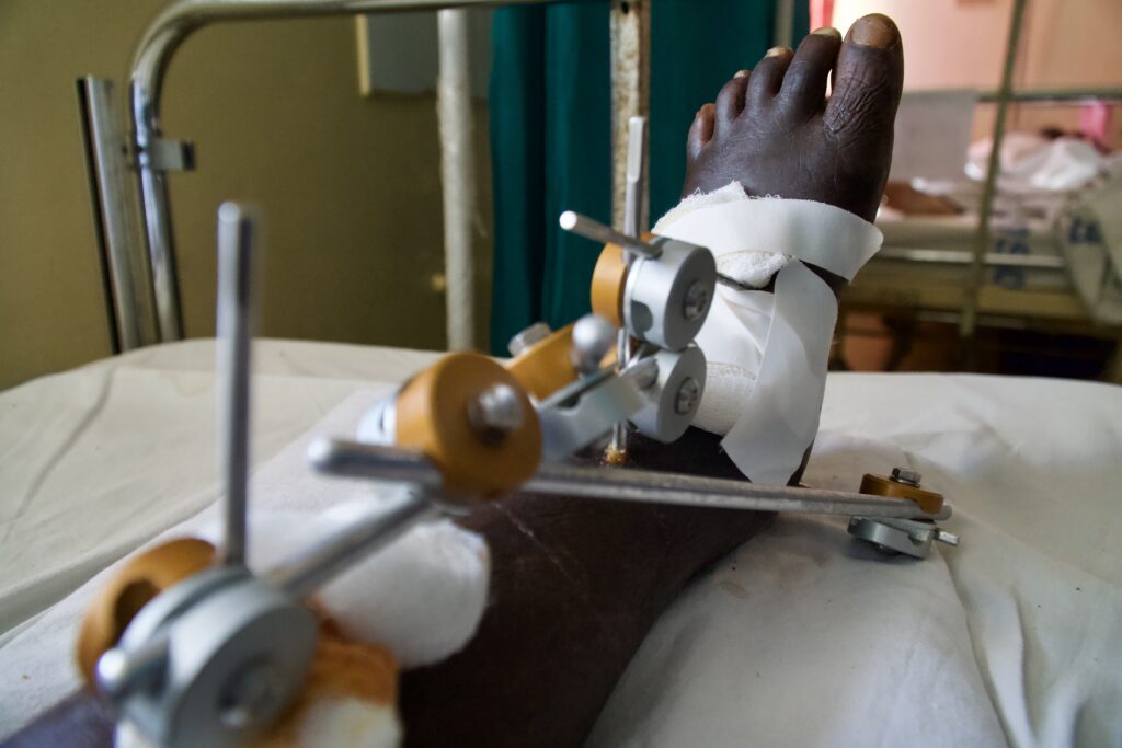Bonesetter Project - Stichting Shirati